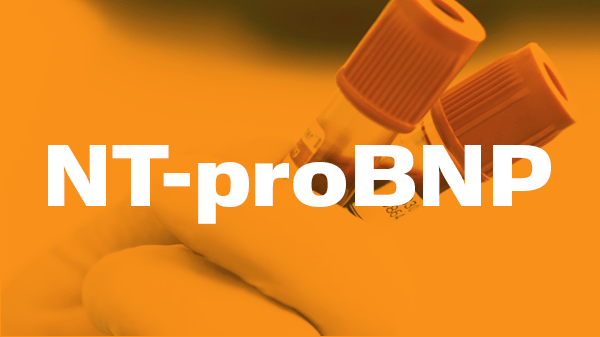 心疾患マーカー・免疫検査-免疫測定装置AQT90 FLEX - Radiometer.co.jp